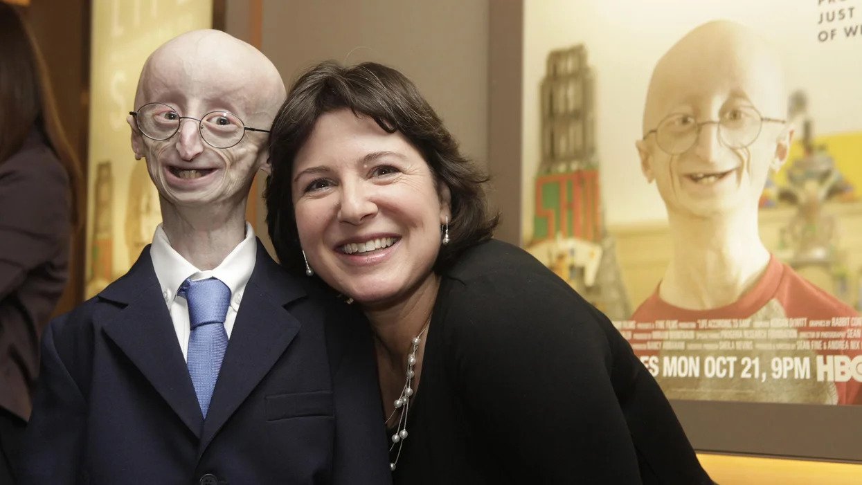 Progeria: New treatment could extend lives of children with 'premature ...