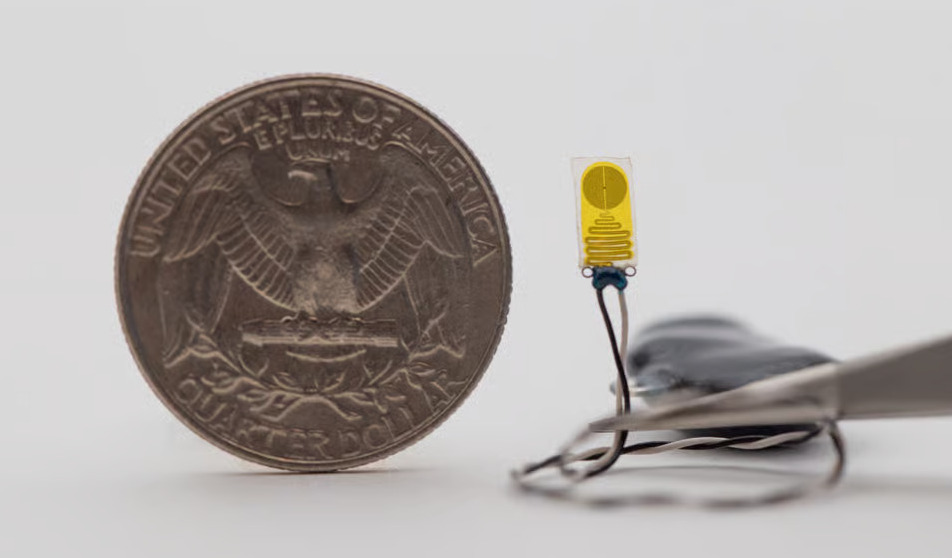 World's first device to monitor transplanted organ health in real-time ...