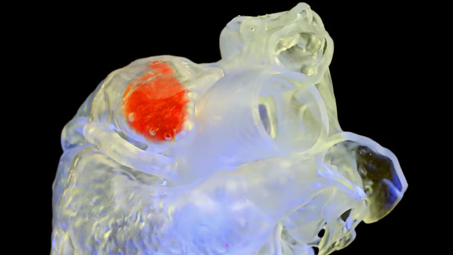 New ultrasound tech could be used to 3D-print implants inside the body ...