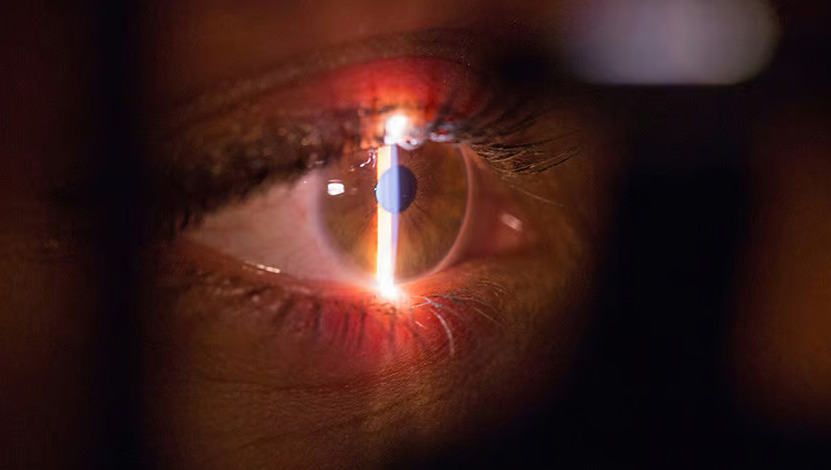 Eye surgeons turn to teeth in astonishing vision treatments - Weird ...