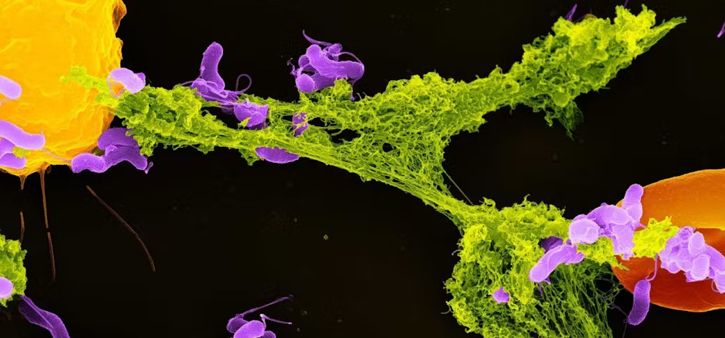 Mitochondria can sense bacteria and trigger your immune system to trap ...